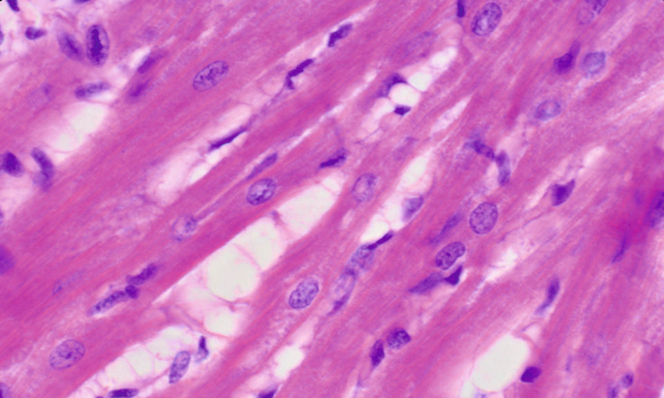 Cardiac Muscle Fibers Microscope Slide – SMARTQAT